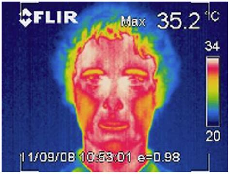 Itis Image Of Front Of Face Download Scientific Diagram
