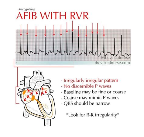 Recognizing Nclex Rn Pn Success Guide For All Nurses Facebook