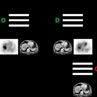 Pdf Cross Modality Synthesis From Ct To Pet Using Fcn And Gan Networks For Improved Automated
