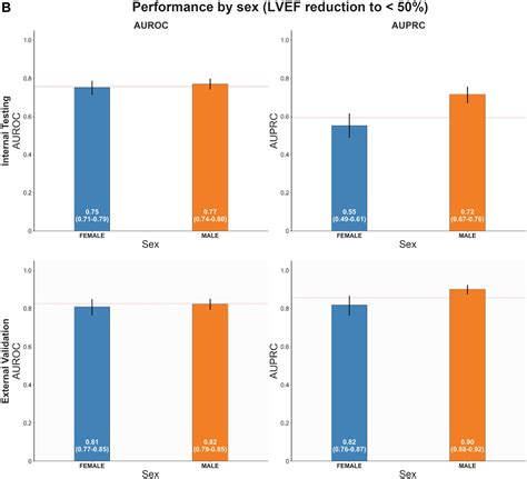 A Novel Ecg Based Deep Learning Algorithm To Predict Cardiomyopathy In A Novel Ecg Based Deep Learning Algorithm To Predict Cardiomyopathy In