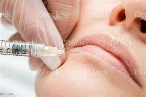 여성의 입술에 보톡스 주사를 만드는 미용사의 손을 감싼다 입술 모양 교정 입술 확대 개념에 대한 스톡 사진 및 기타 이미지