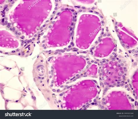 Simple Cuboidal Epithelium Thyroid