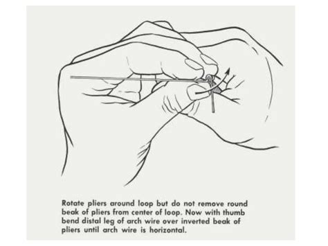 loops in orthodontics t loop bull loop vertical loop mushroom loop stop loop pptx dental