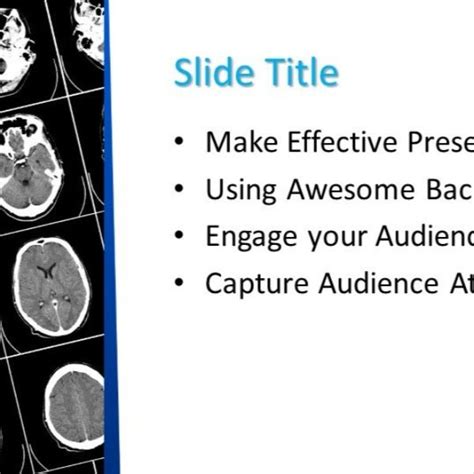 Free Computed Tomography Powerpoint Template Powerpoint Template Free