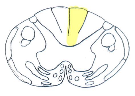 Spinal Cord Brain Stem Cross Sections ~labeling~ Flashcards Quizlet