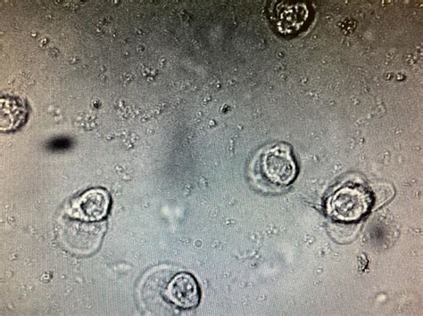 What Kind Of Contamination In Cell Line It Could Be ResearchGate