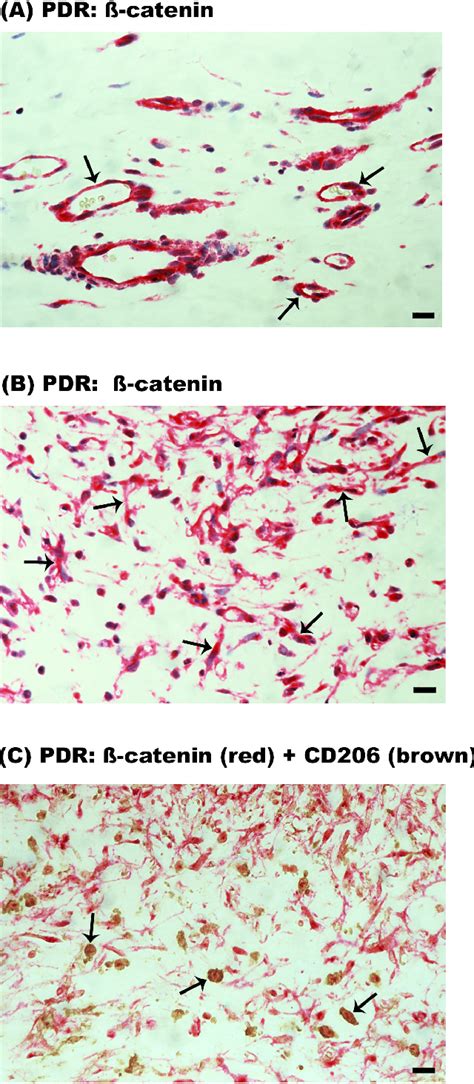 Figure 11 From Macrophage Myofibroblast Transition Contributes To Myofibroblast Formation In