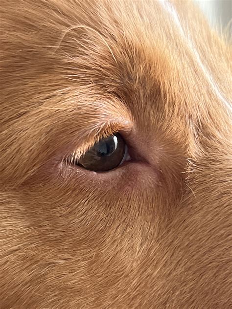 White Bump On Eyelid