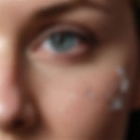 Understanding The Tearlab Osmolarity Test For Dry Eye