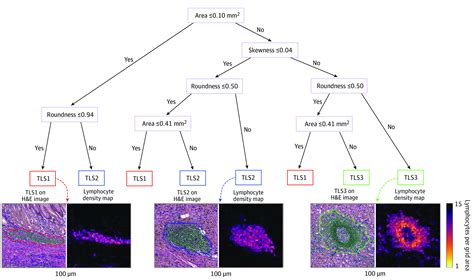Development And Validation Of A Machine Learning Model For Detection And Classification Of