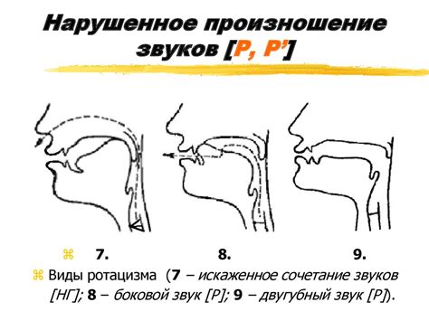 Приёмы исправления нарушенных звуков речи - презентация онлайн