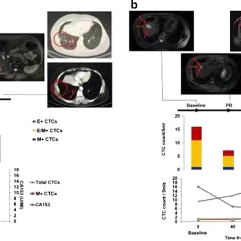 Comparison Of Total Ctc Count Ctc Phenotype Serum Tumor Markers And Download Scientific