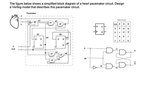 Pacemaker Schematic Diagram