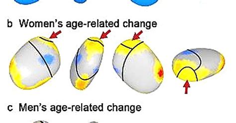 노화에 따른 남녀 뇌의 변화 모습