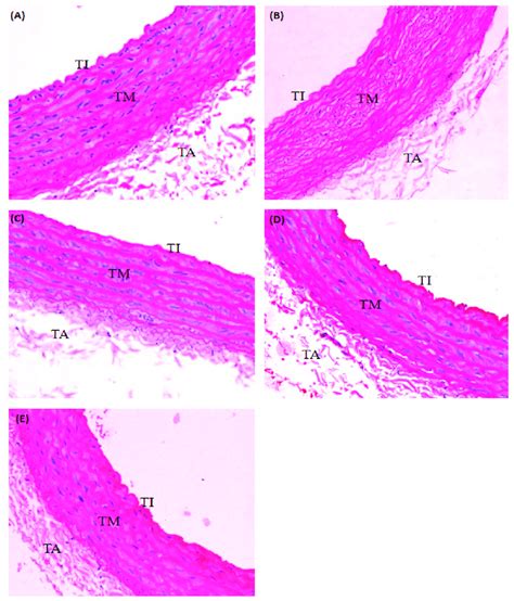 Hande Staining Of Rat Aorta Captured Under 40× Magnifications A Aorta Download Scientific
