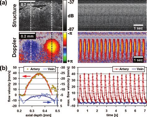 A Single Structural Oct Image And Color Encoded Doppler Phase Shift Download Scientific