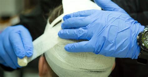 Tv Sex Scene Goes Wrong Actors End Up Hospitalized