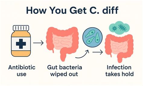 What Is C Diff And How Do You Get It What Is C Diff And How Do You Get It