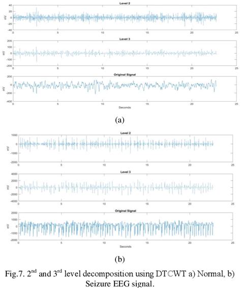 Table 1 From Classification Of Eeg Signals In A Seizure Detection System Using Dual Tree Complex