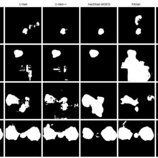 Visual Representation Of The Input Colonoscopy Images And The