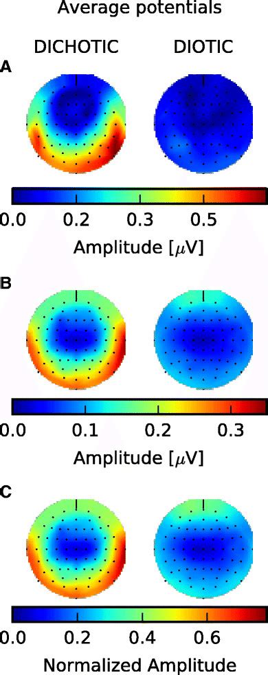 Spectral Amplitude Across Scalp Electrodes Obtained For The Interaural Download Scientific