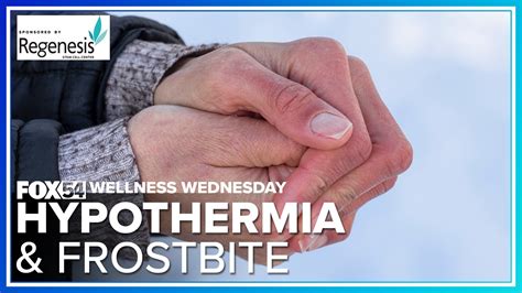 Wellness Wednesday Avoiding Hypothermia And Frostbite