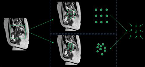 Comparison Of Regular And Deformable Convolution Download Scientific Diagram