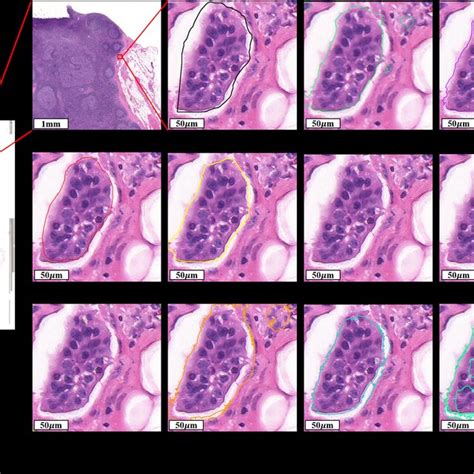 Visualization Of Conventional And Dilated Convolution A Conventional Download Scientific