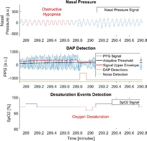 Figure 3 From Detection And Classification Of Sleep Apnea And Hypopnea Using Ppg And Spo 2
