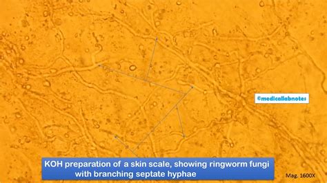 Koh Wet Mount Preparation Introduction Principle Test Require