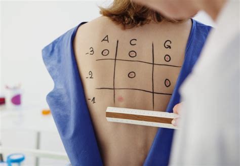 Intradermal Skin Testing Allergy Asthma And Sinus Associates