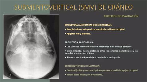 Posicion Y Proyeccion Craneo Pptx