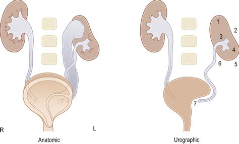 Paediatric Genitourinary Disorders Clinical Tree