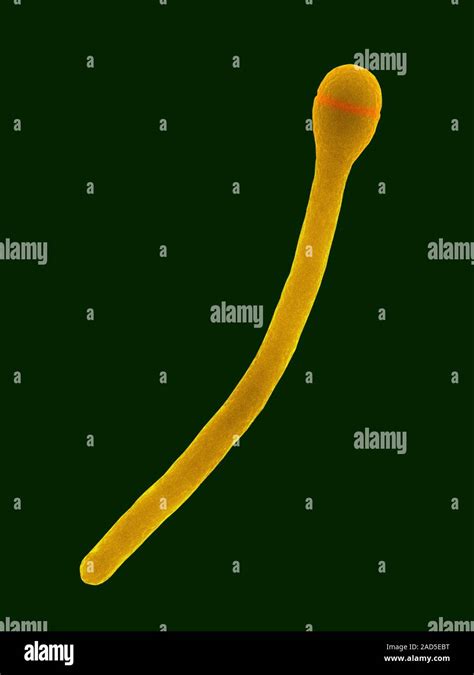 Coloured Scanning Electron Micrograph Sem Of Clostridium Phytofermentans Gram Positive