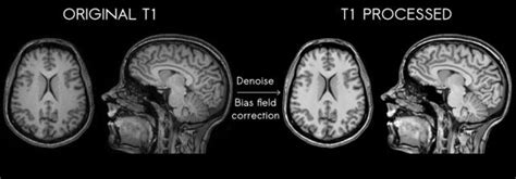 The Fast Fourier Convolution Network A Fast And Efficient Approach For