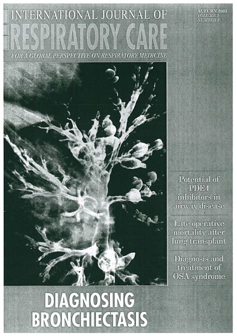 PDF Obstructive Sleep Apnoea Syndrome Diagnosis And Treatment