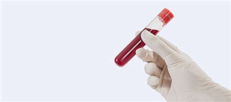 Hemogram Testi Fiyatları 2025 İstanbul Laboratuvarları Medhome