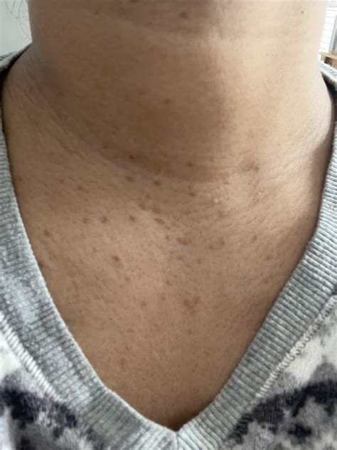 Routine Help Help Please Rskincareaddiction