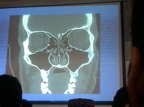 Lecture Slides Ent Dns