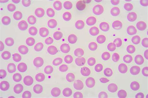 Morfología De Eritrocitos Foto De Stock Y Más Banco De Imágenes De 2015