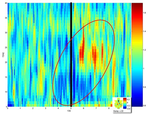 Referenced Short Time Amplitude Eeg Spectra Time Development Ic No Download Scientific
