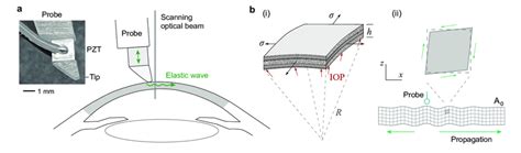 A Schematic Of Optical Coherence Elastography Using A Contact Probe Download Scientific