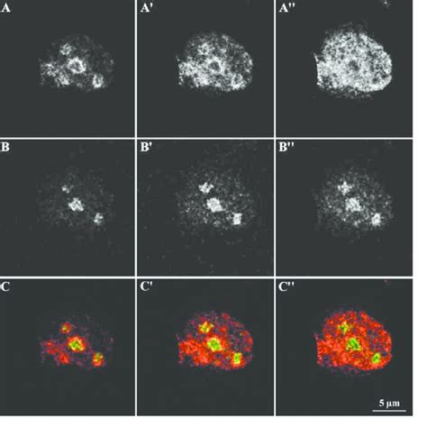 Perinucleolar Accumulation And Nuclear Pattern Of Prosomes The In Situ