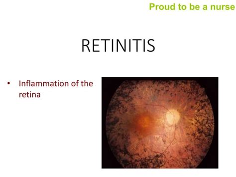 Retinitis Pptx