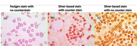 Nuclei Detection In Different Image Modalities Image Reproduced From