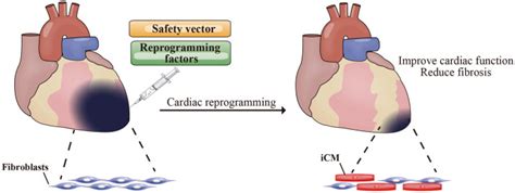 Direct Cardiac Reprogramming ― Converting Cardiac Fibroblasts To Cardiomyocytes ― Pmc