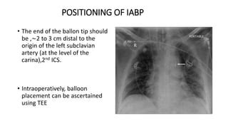 Iabp Presentation Pptx