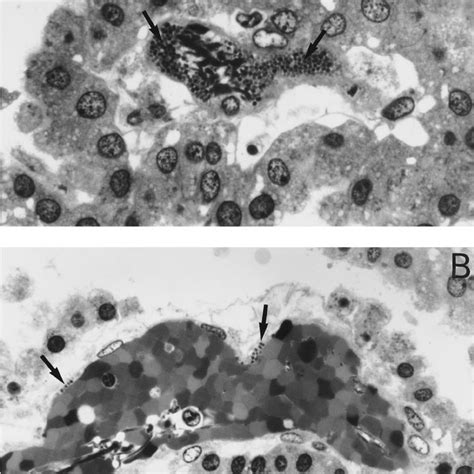 Sections Of Capillaries Of Choroid Plexus Stained With Toluidine Blue Download Scientific
