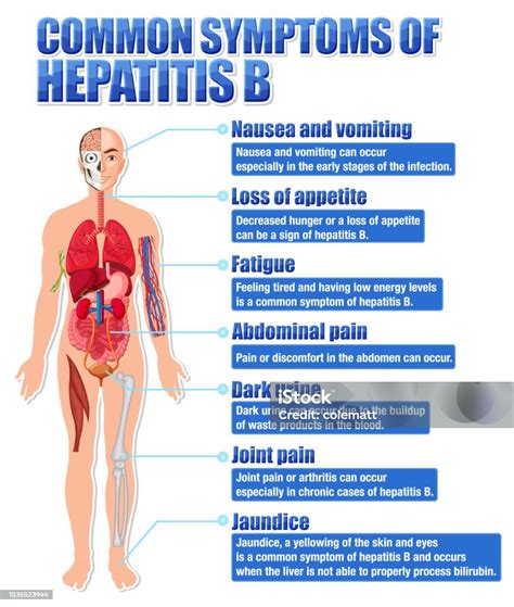 Informative Poster Of Common Symptoms Hepatitis B Stock Illustration