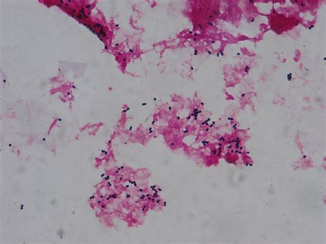 Enterococcus Casseliflavus〔黄色い腸球菌〕 グラム染色 Gram Stain